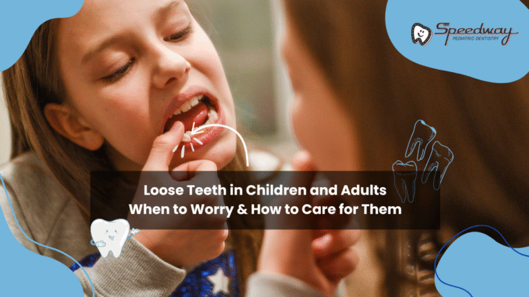 Loose Teeth in Children and Adults — Speedway Pediatric Dentistry